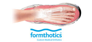 Formthotics for better foot posture and comfort at Swansea Clinic
